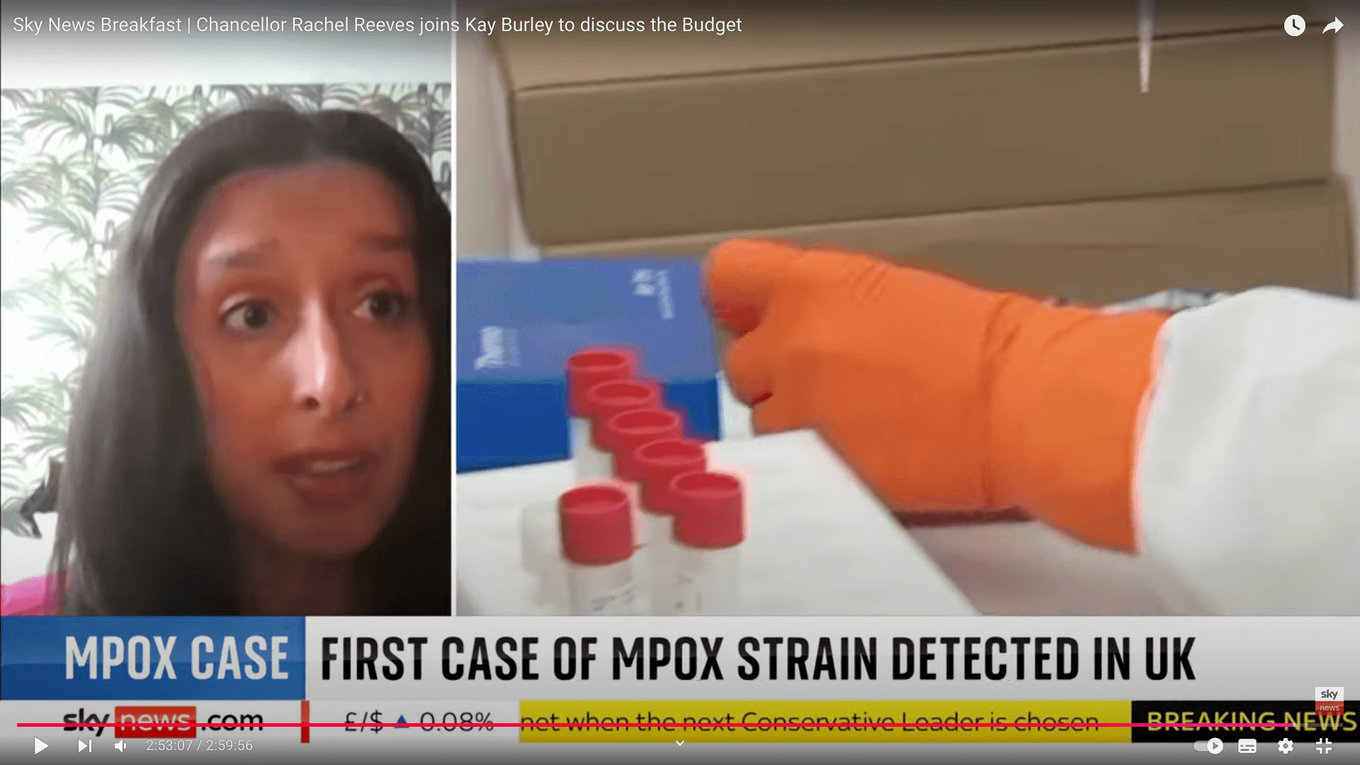 First strain of Mpox strain detected in the UK - VERDI PROJECT